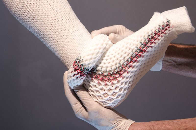 Leg Cast Instructions - Home Page : Home Page